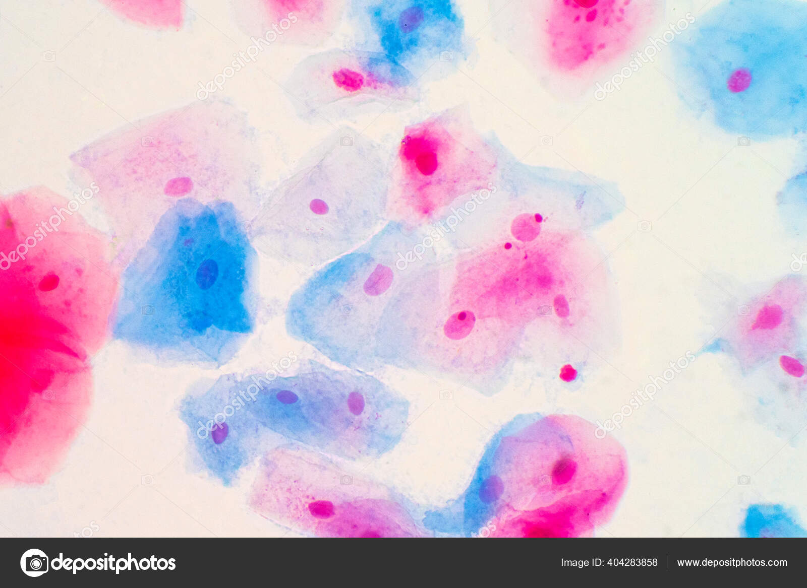 Squamous Epithelial Cells Under Microscope