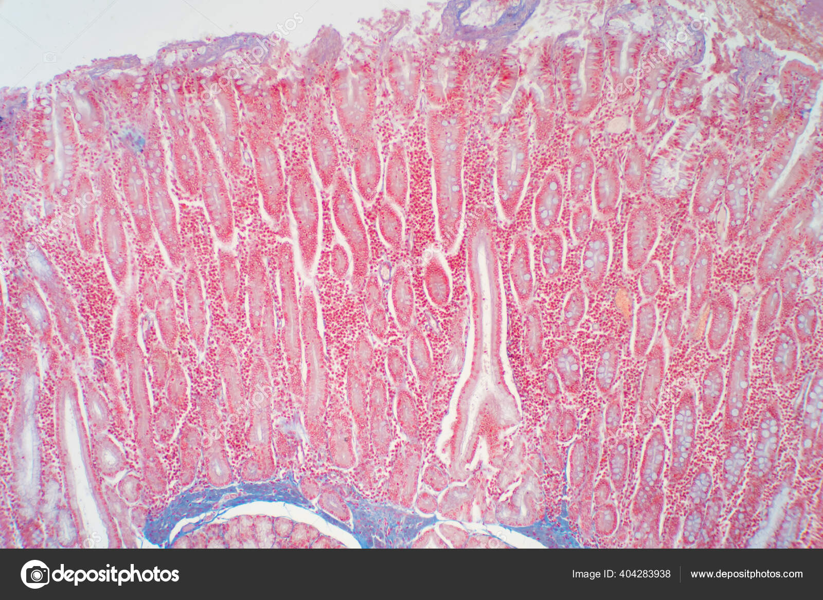 Human Duodenum Histology