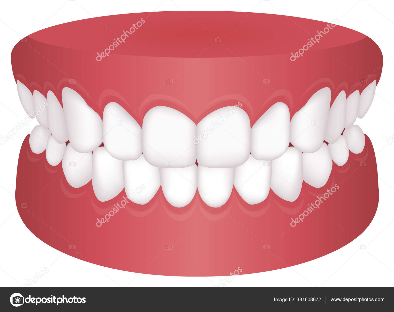 Teeth Trouble Bite Type Vector Illustration Normal Bite Stock Vector ...