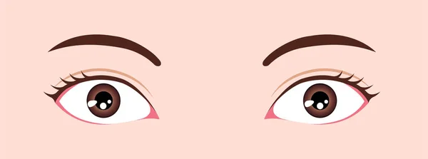 Comparison Illustration Normal Dry Eye Stock Vector Image by ©barks ...
