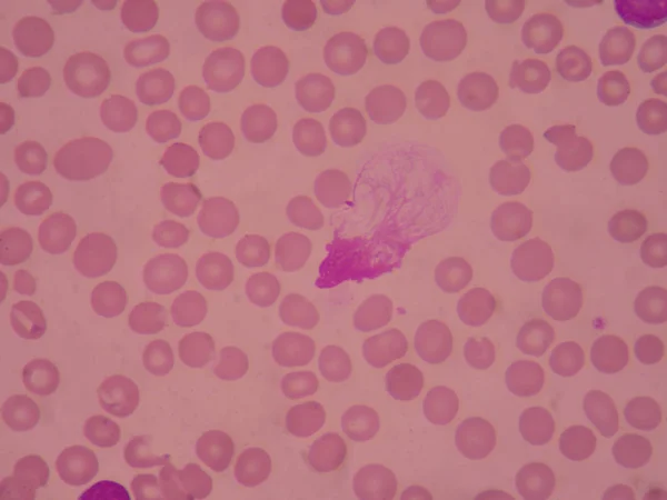Red blood cells and white blood cells on white — Stock Photo © toeytoey ...