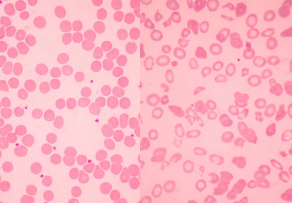 75 illustrations de Test de frottis | Depositphotos