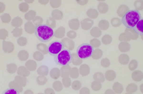 Blast cell Stock Photos, Royalty Free Blast cell Images | Depositphotos