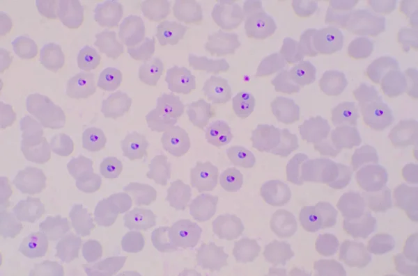 Celula De Plasmodium Falciparum EXPORT AND TRAFFICKING OF Plasmodium