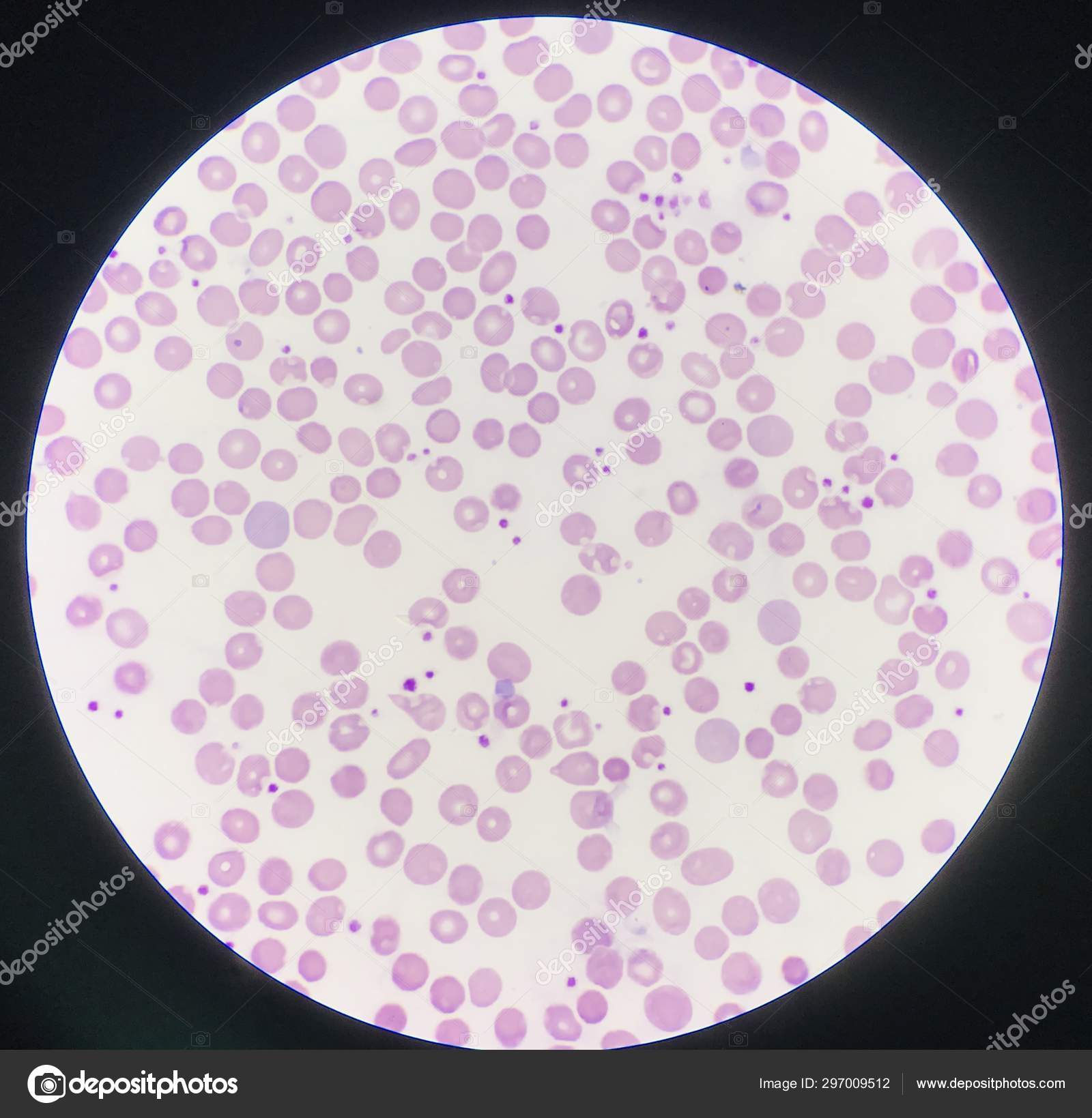 Red Blood Cell Microscope 100x