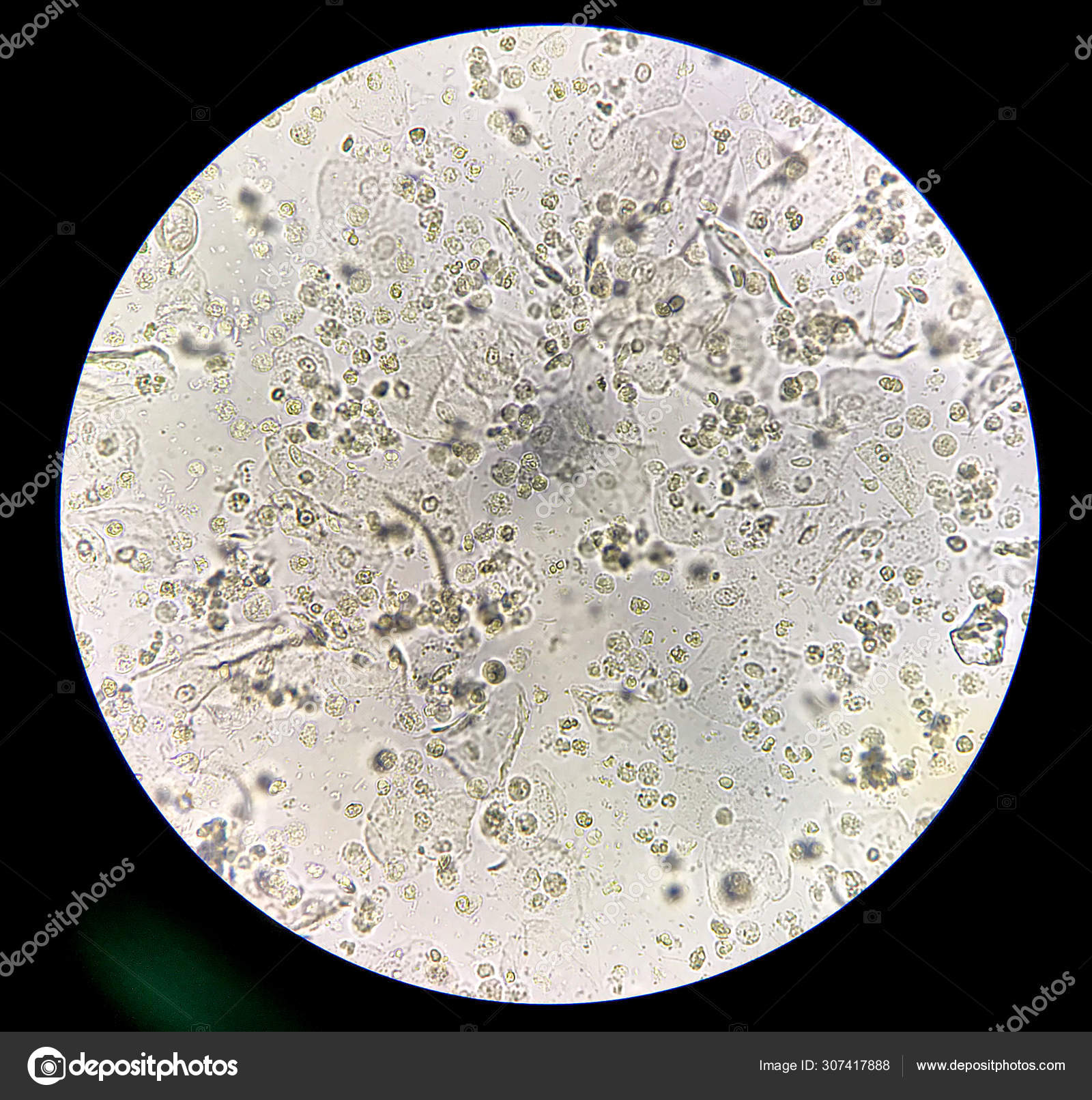 Bacteria In Urine Under Microscope