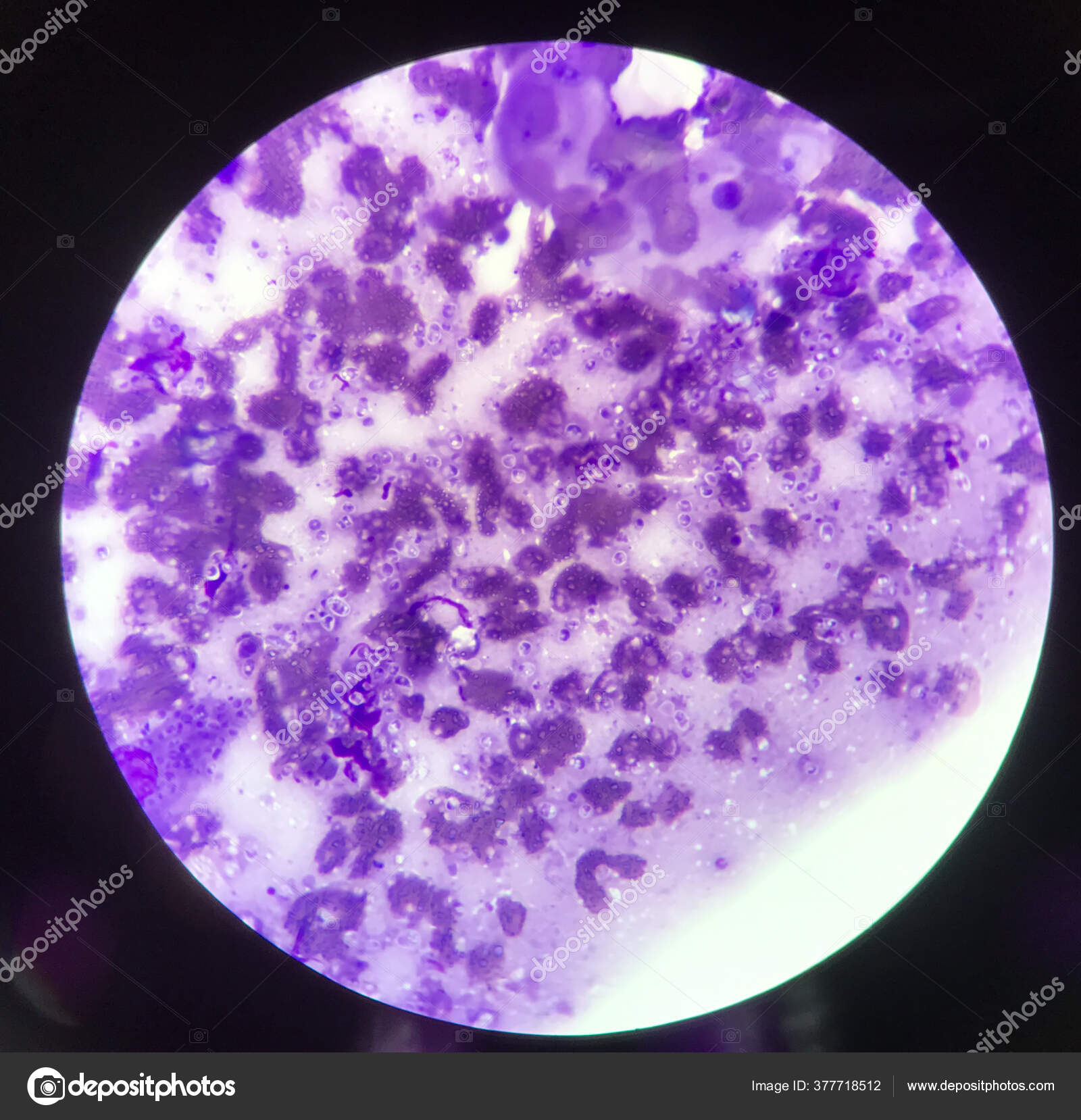 Budding Yeast Cells Binary Fission Cells Smear Laboratory Science ...