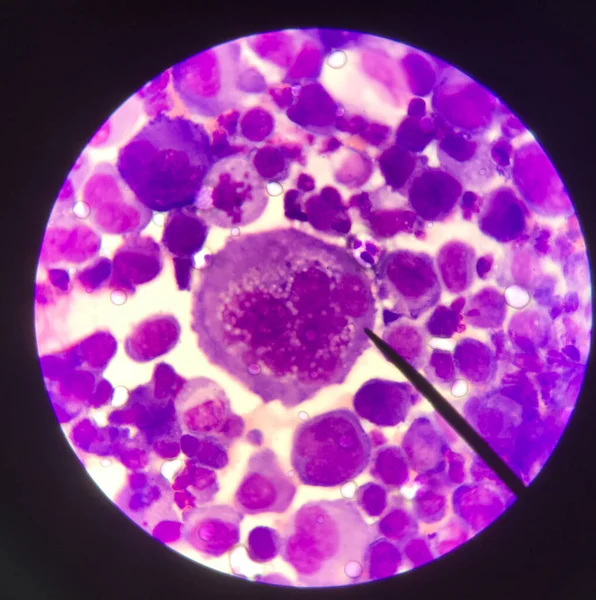 Abnormal cells Images - Search Images on Everypixel