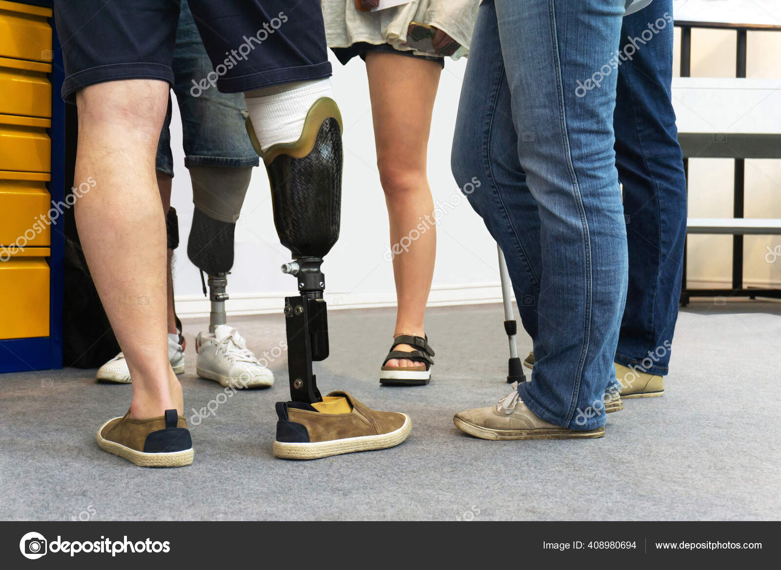 Prosthetic Leg Group People Disabilities Standing Indoors Cropped Frame ...