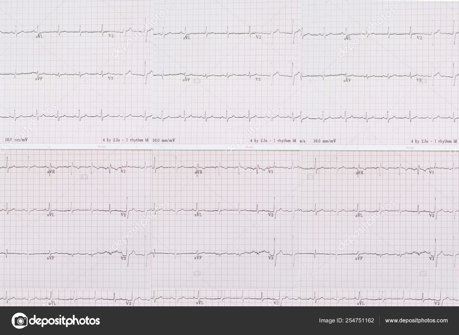 Electrocardiogram Paper Medical Background Stock Photo by ©Ai825 254751162