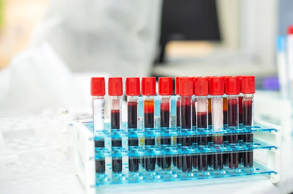 Doctor Hand Taking Blood Sample Tube Rack Machines Analysis Lab — Stock ...