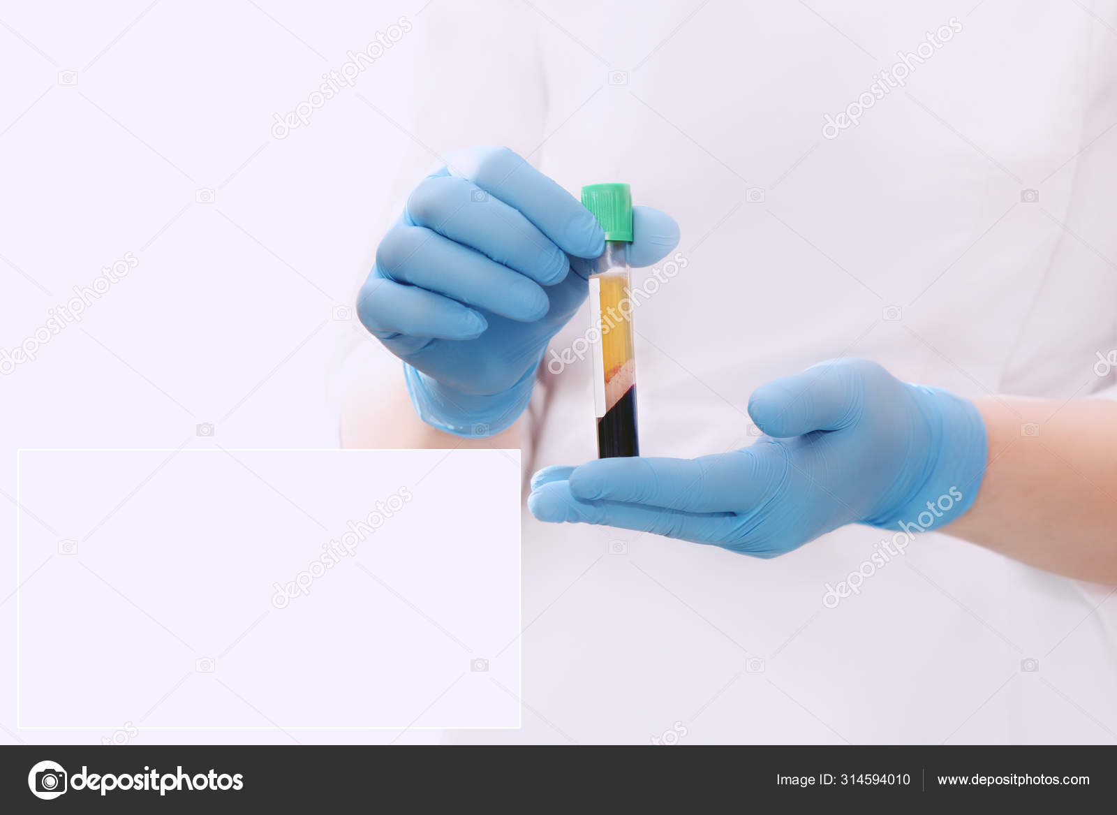 PRP therapy. Medical vial in doctor's hands Stock Photo by ©ozina 314594010