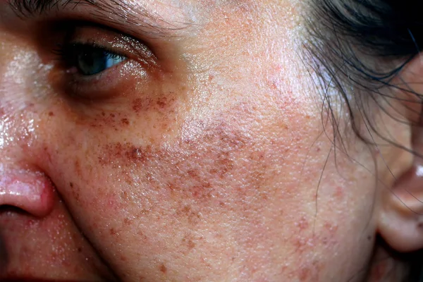 Spot face Images - Search Images on Everypixel