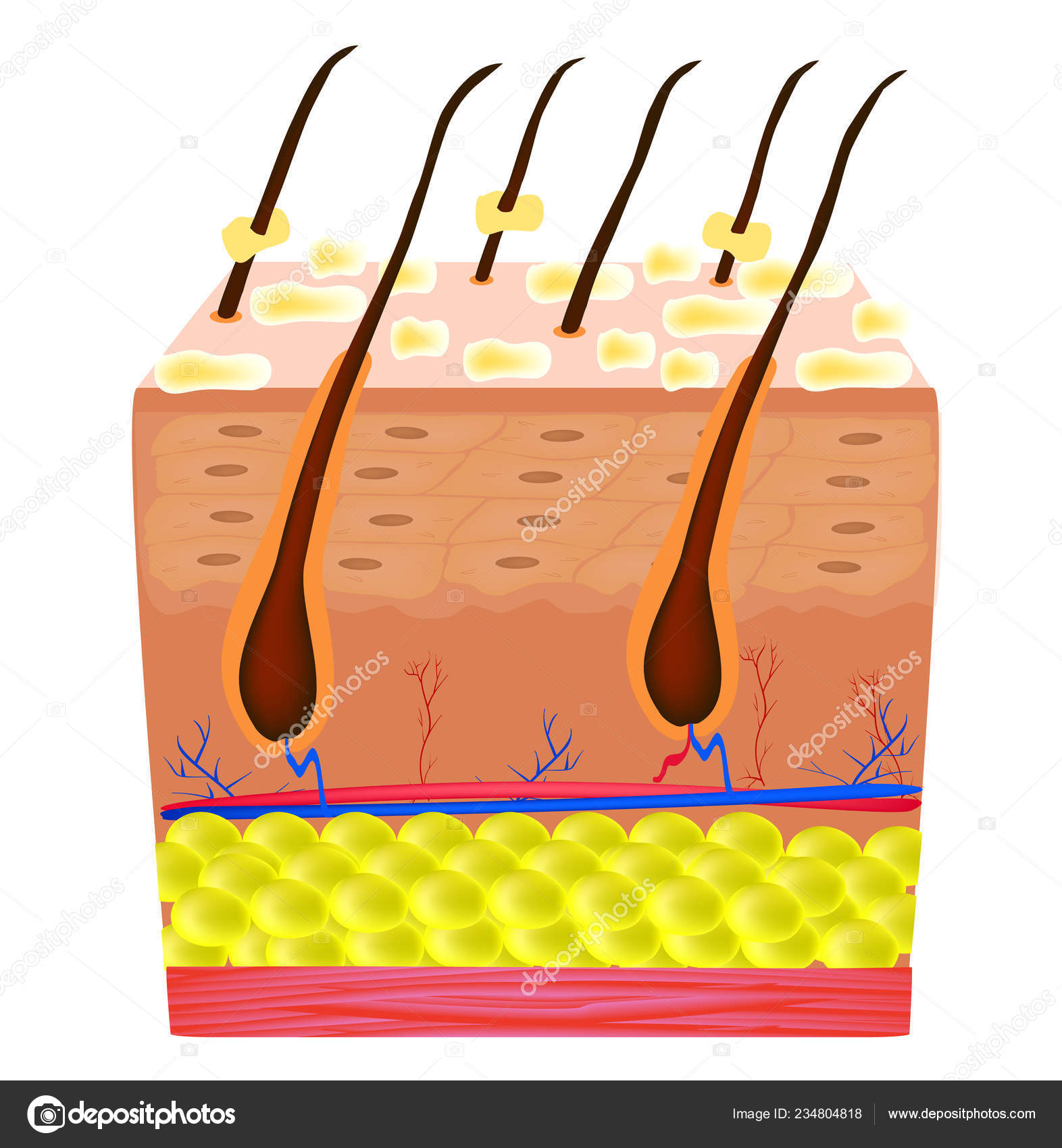 Seborrhoe Haut Und Haare Schuppen Seborrhoische Dermatitis Dysfunktion ...