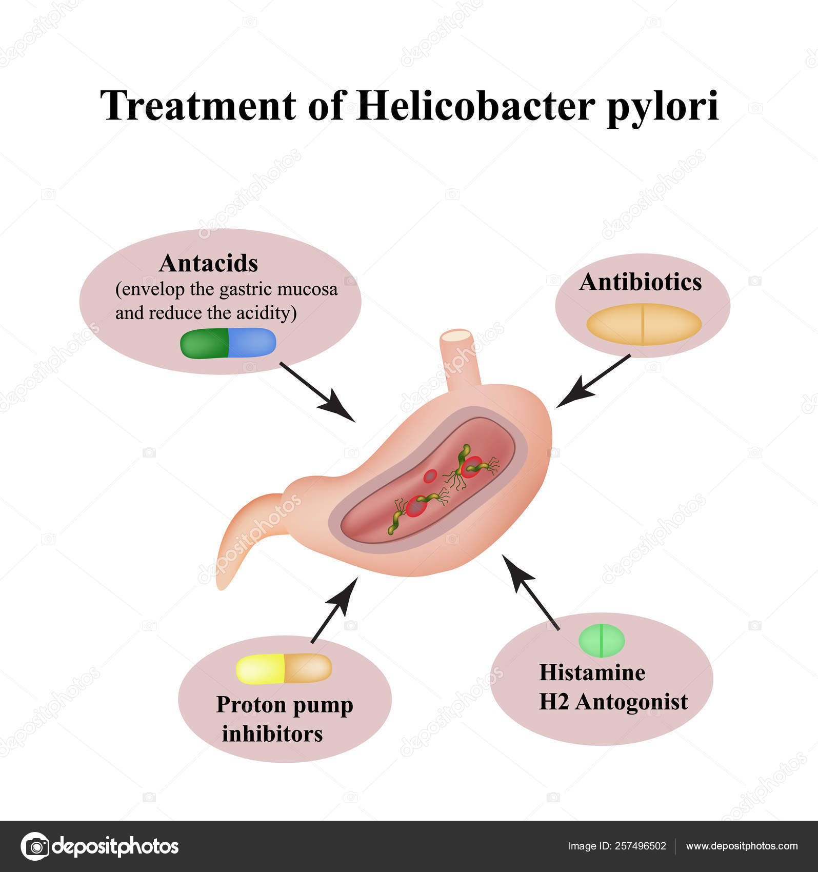 Tratamiento Helicobacter Pylori