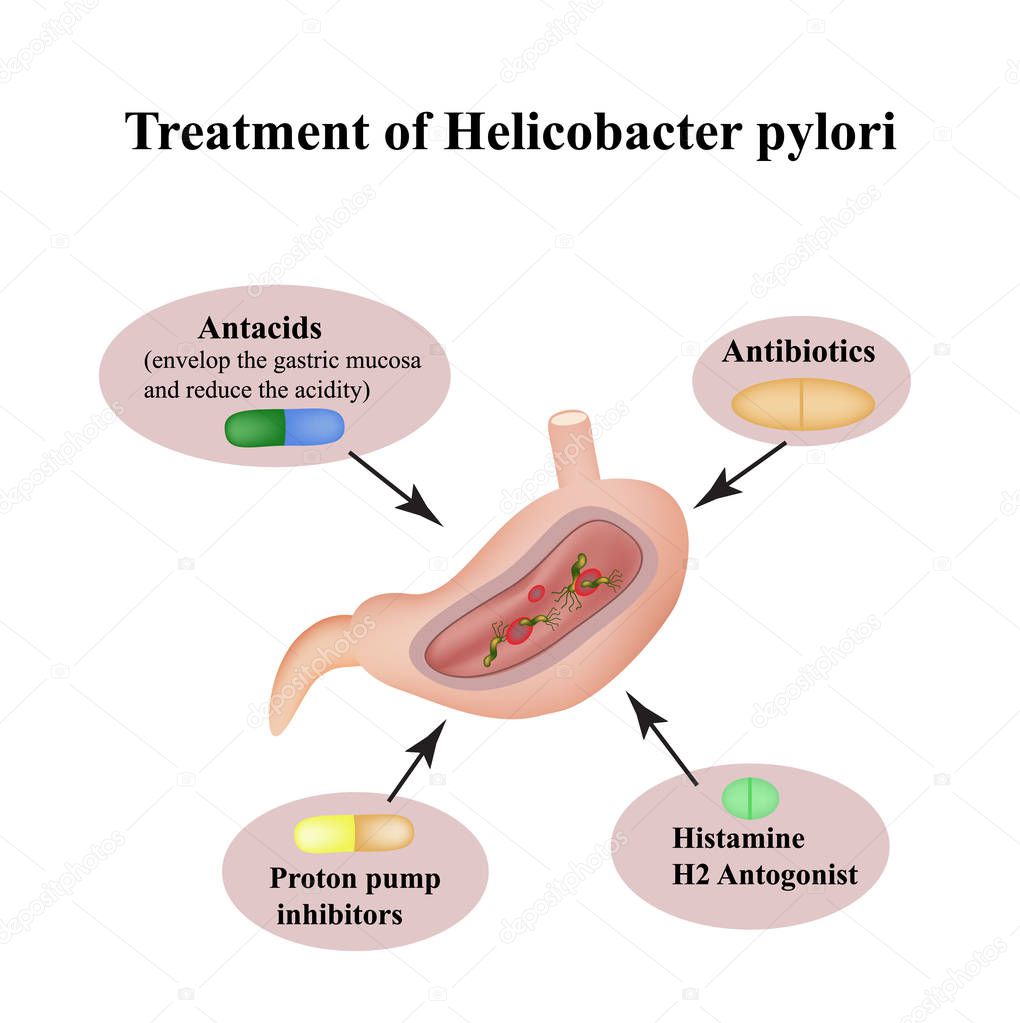 Tratamiento de Helicobacter pylori. Medicamentos. Anti cidos ...