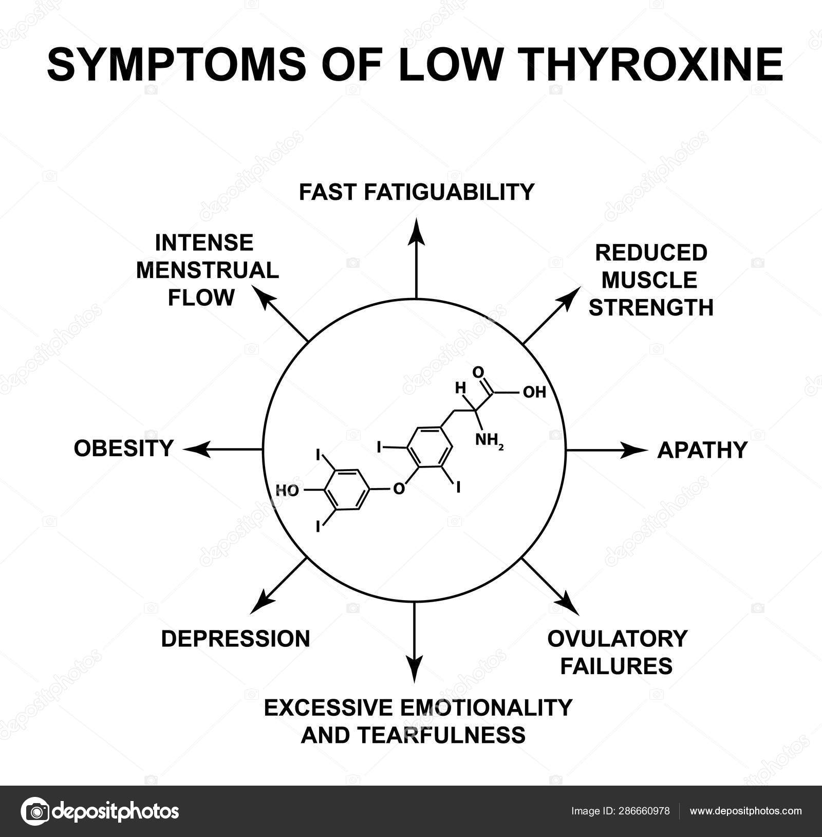 Symptoms of low thyroxine. Thyroxine thyroid hormone. Infographics ...