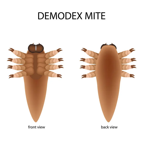 The structure of the demodex mite. Demodecosis. Infographics. Vector ...