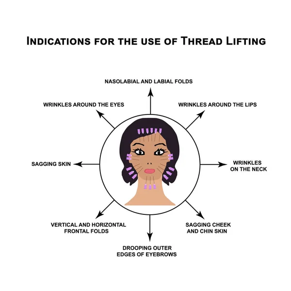 The effect of thread lifting. Threads for a facelift. Mesotherapy ...