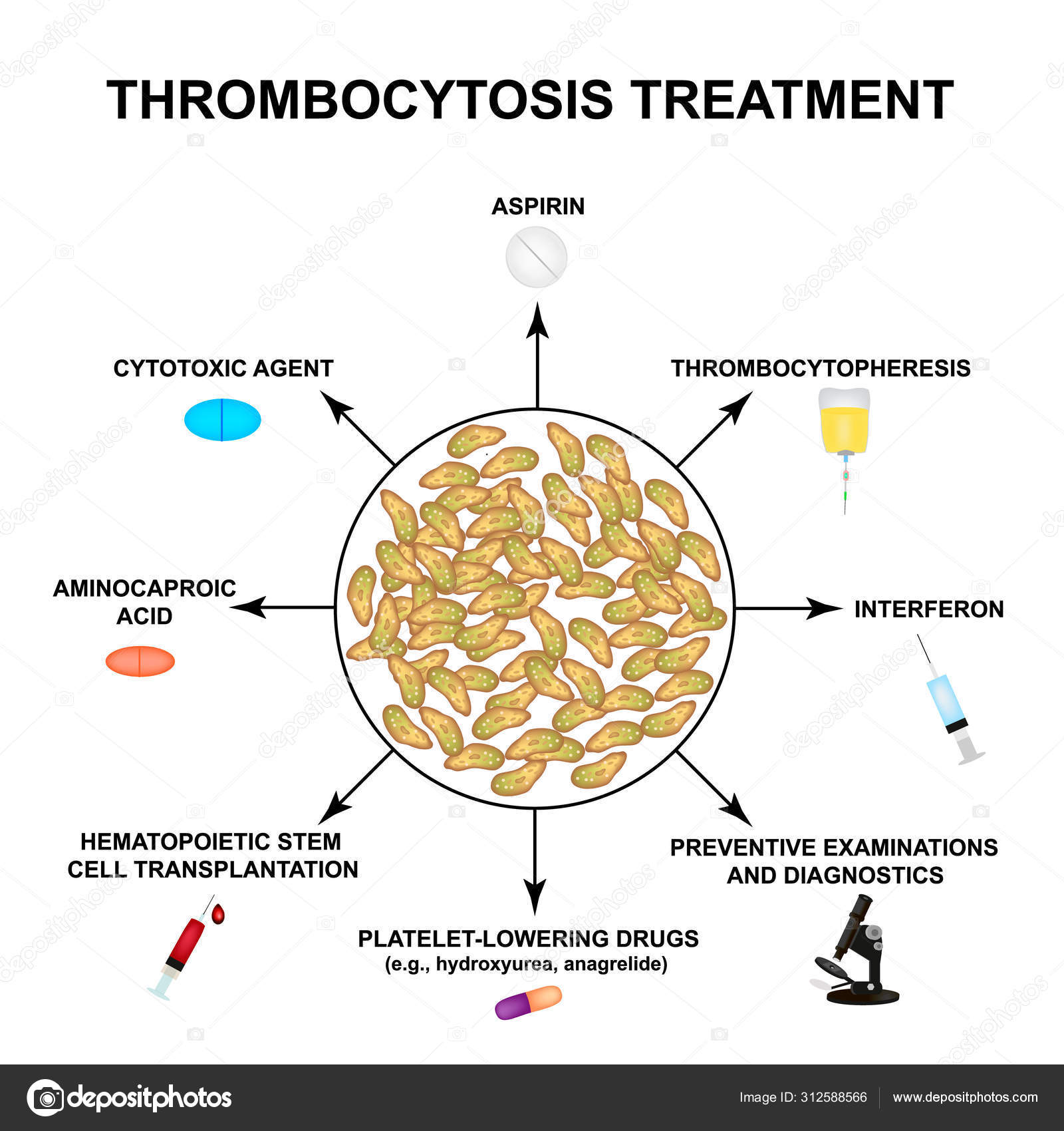 Thrombocytosis treatment. An increase in platelets in the blood ...