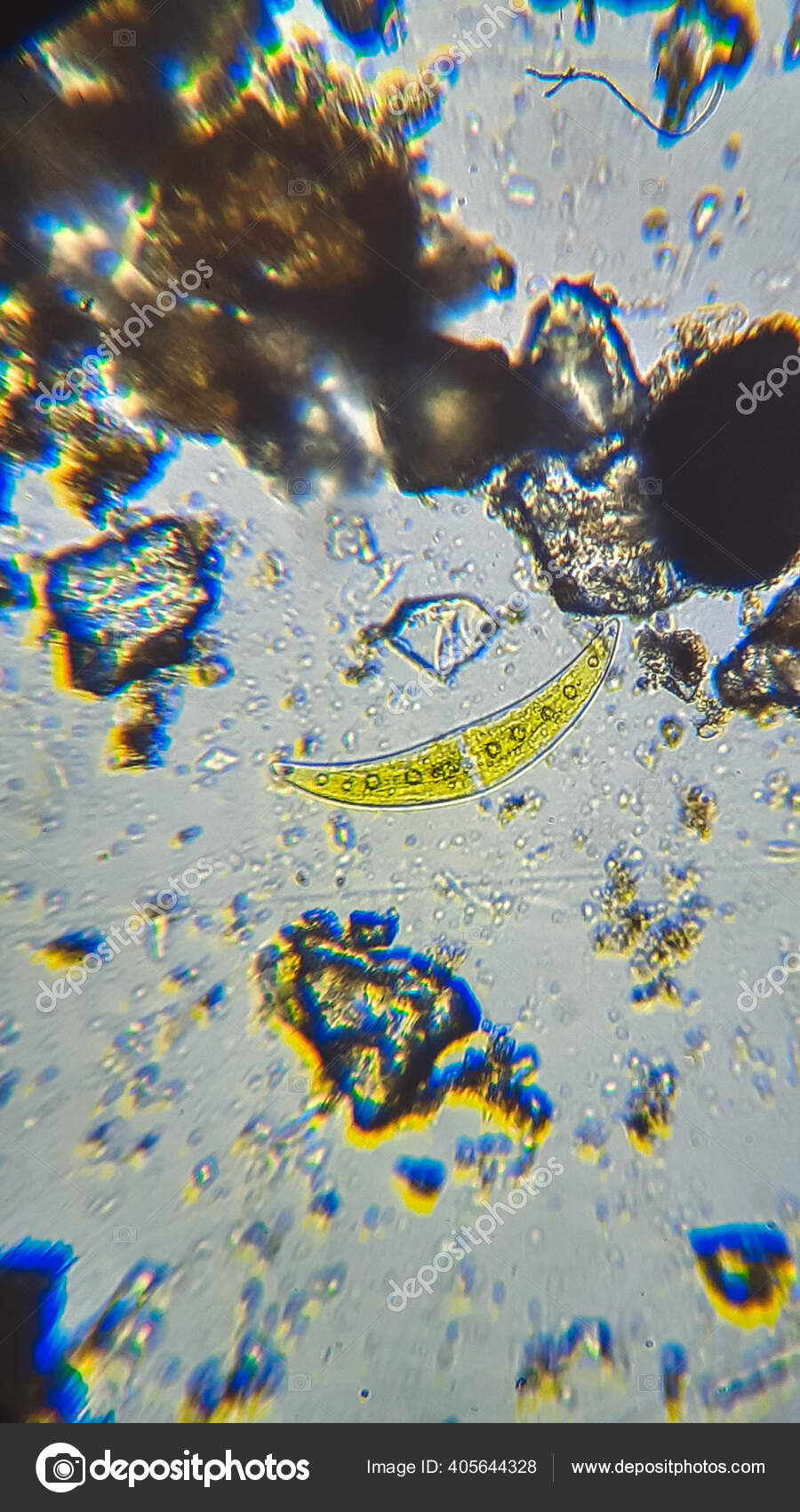 Mycetozoa slime mold and Purple sulfur bacteria PSB in dead shell of ...