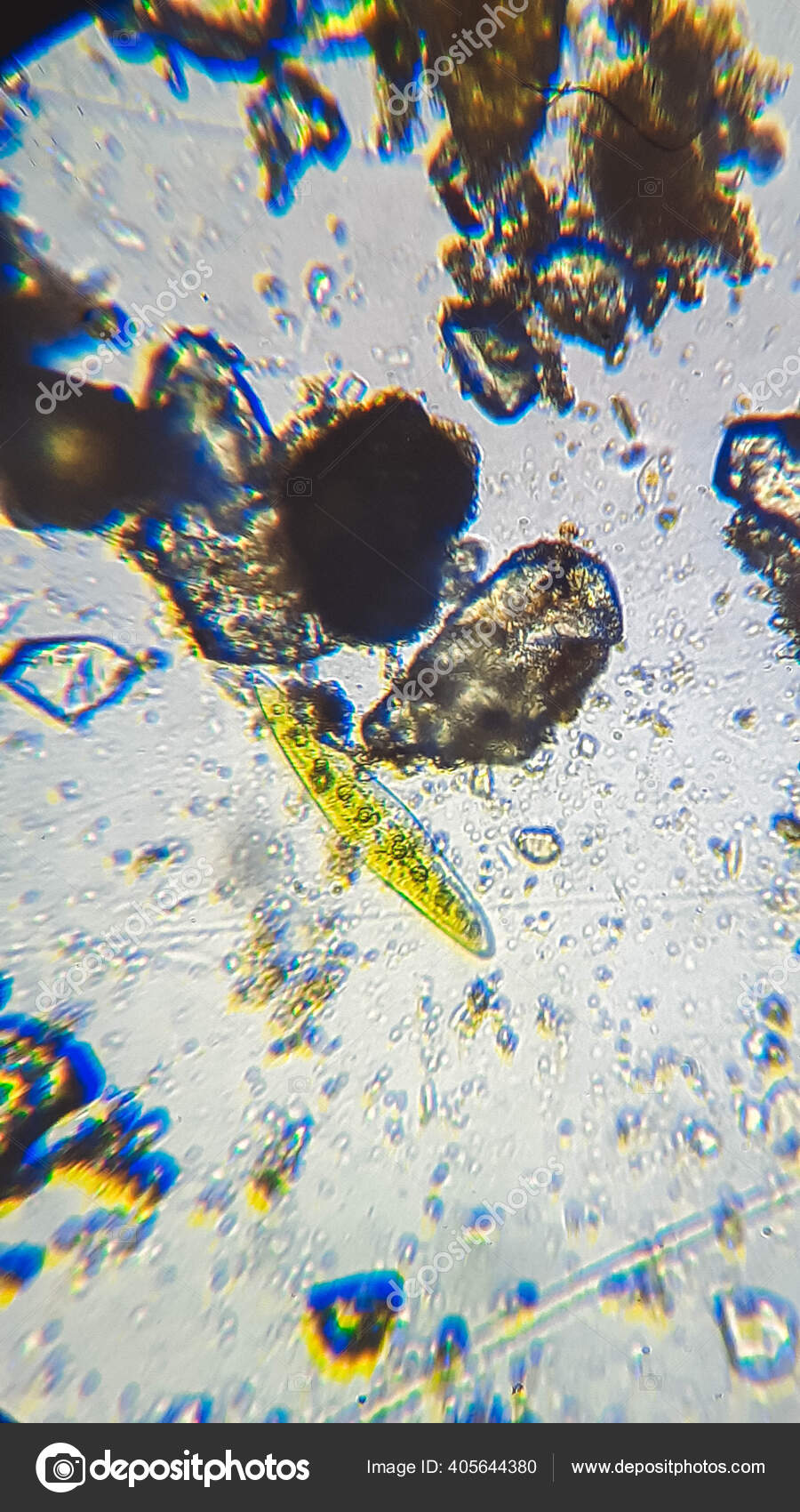 Mycetozoa slime mold and Purple sulfur bacteria PSB in dead shell of ...