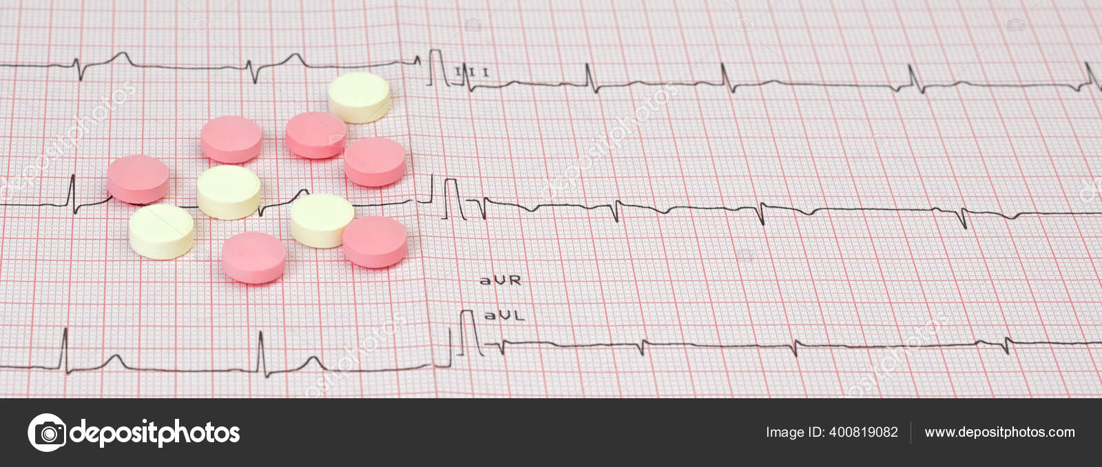 Ecg Rhythm Artificial Pacemaker Ventricular Pacing Pills Desk Stock ...