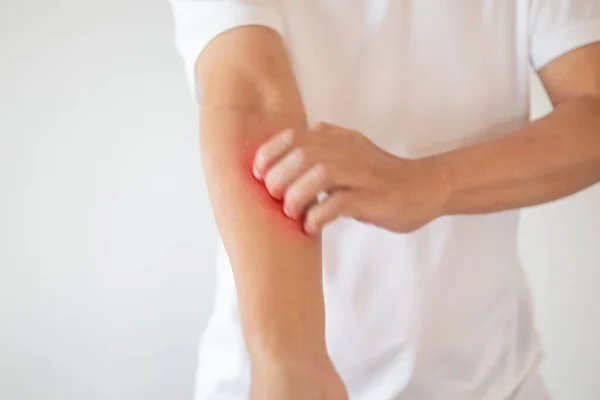 man itching and scratching on arm from itchy dry skin eczema dermatitis ...
