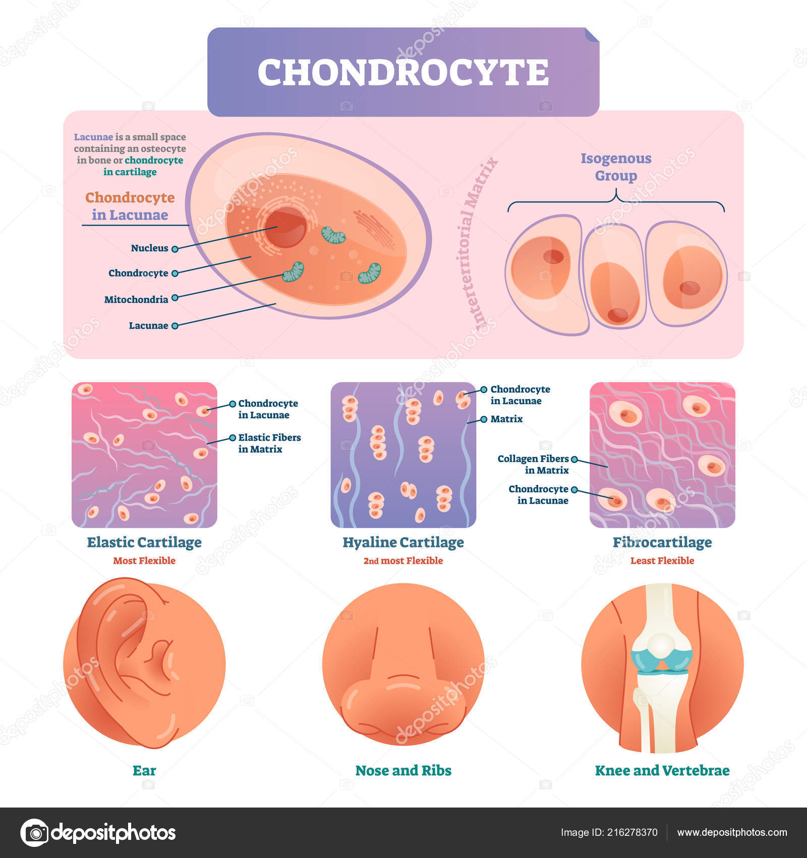 Chondrocyte vector illustration infographic. Diagrama médico de ...