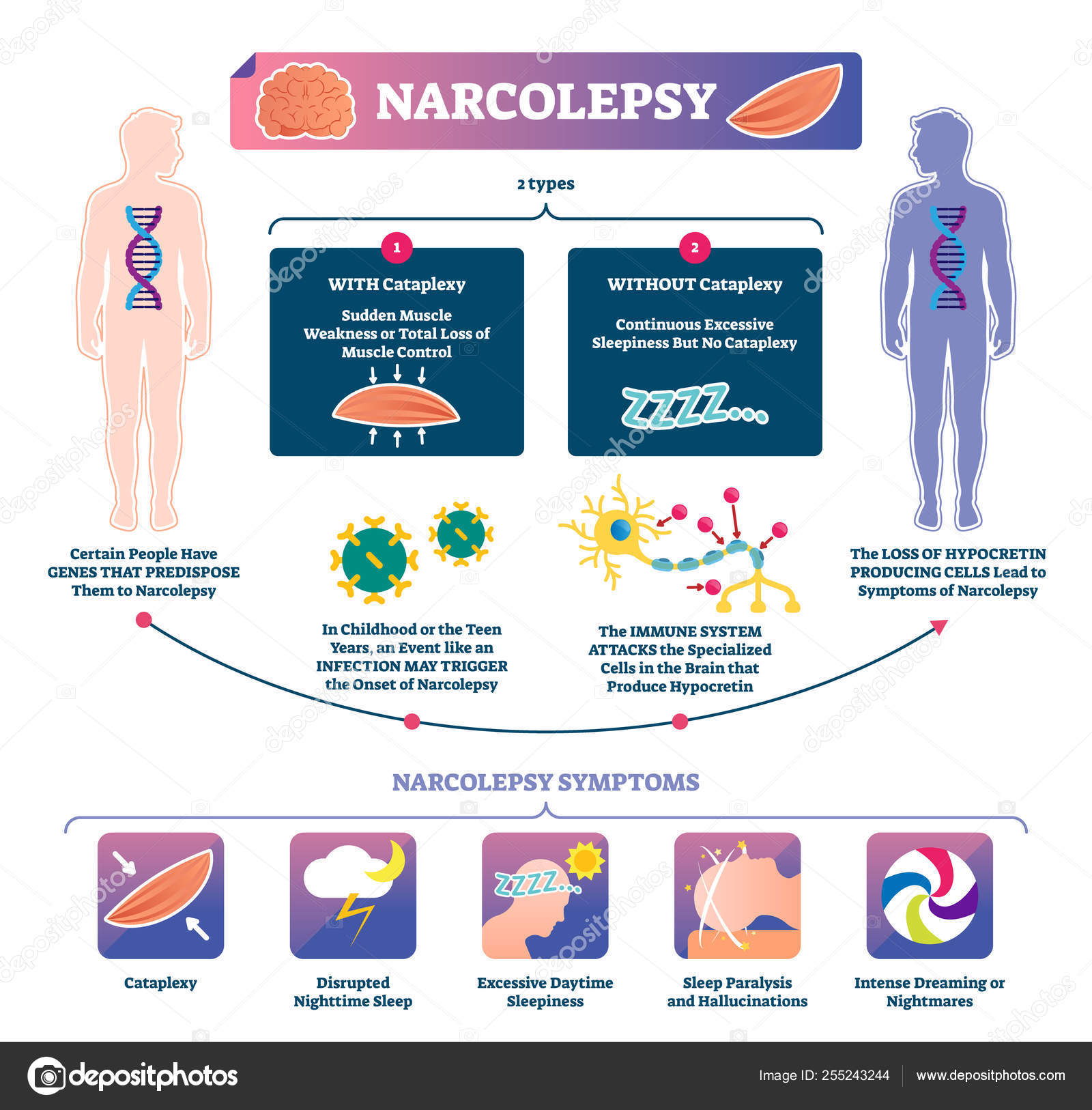 Narcolepsy vector illustration. Labeled muscle strength disease ...