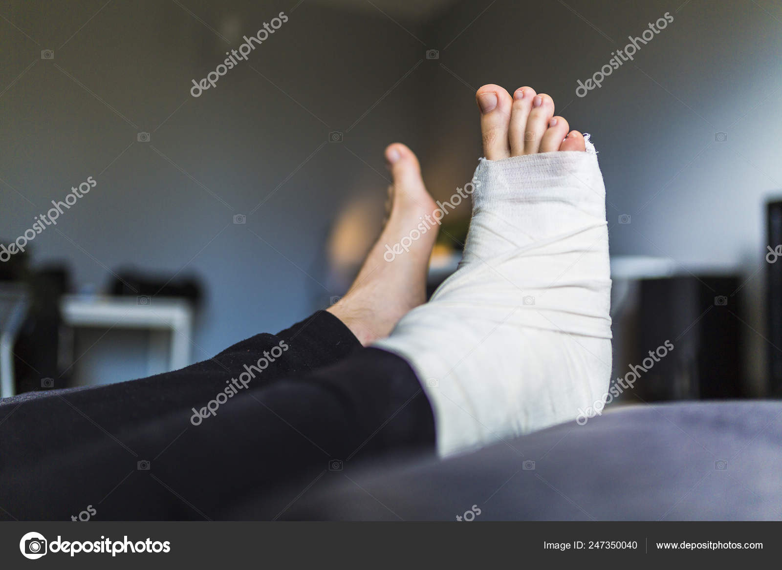 Descansando con una pierna rota en casa: fotografía de stock ...