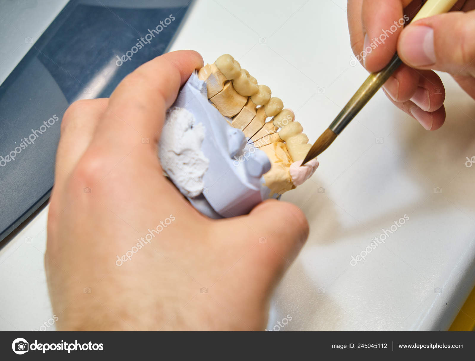 Technician Dental Working Complete Lower Upper Metal Ceramic Prosthesis ...