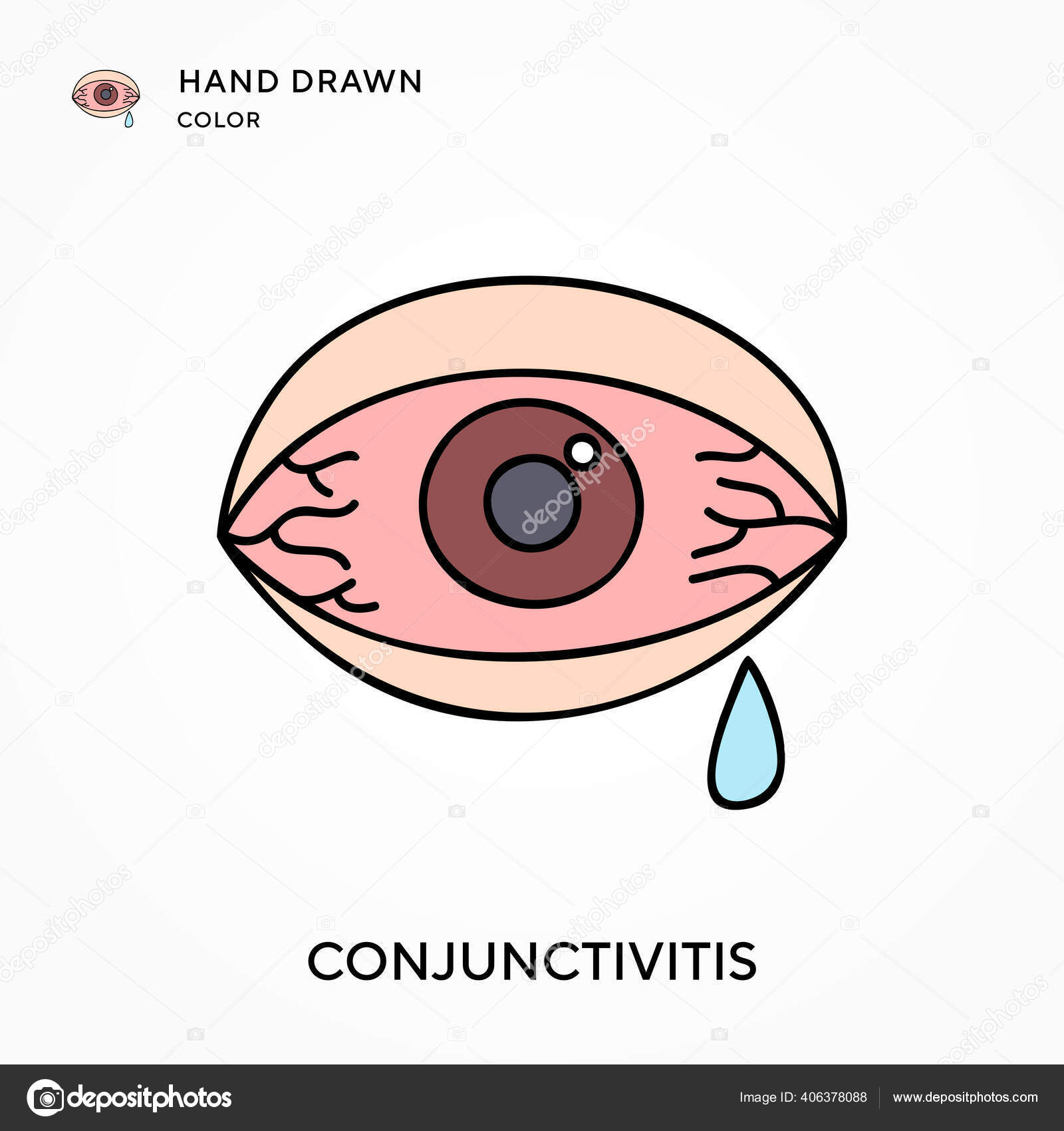 Conjunctivitis Hand Drawn Color Icon Modern Vector Illustration ...