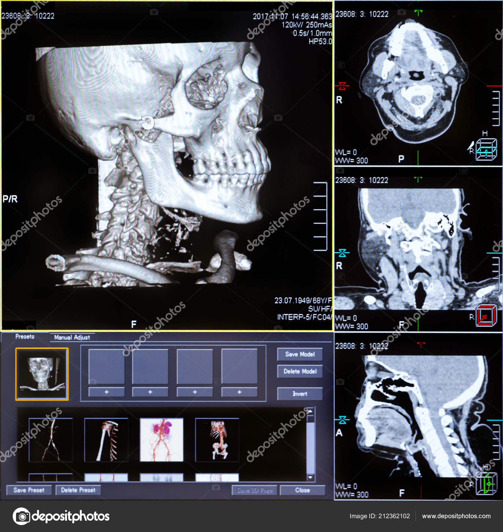 Magnetic Resonance Imaging Mri Scan Scans Human Head Ultrasound ...