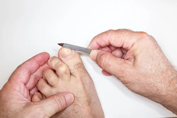 Hammer toes Stock Photos, Royalty Free Hammer toes Images | Depositphotos