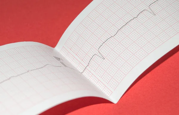 Polygraph Needle And Drawing Stock Photo by ©albund 46086725