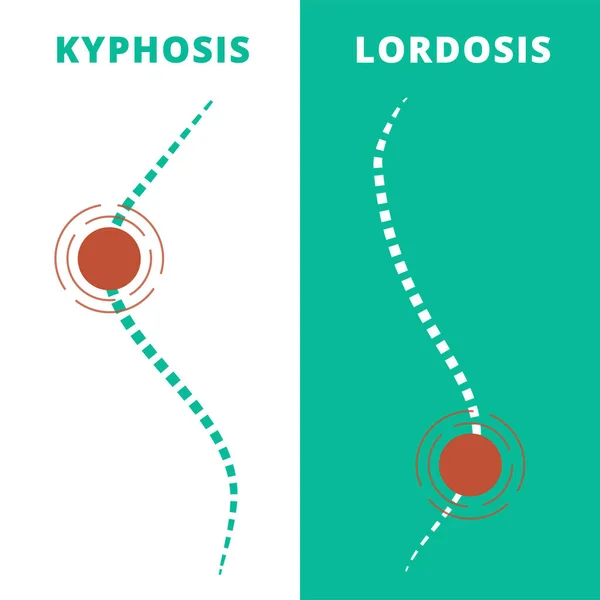 Maladies Colonne Vertébrale Scoliose Lordose Cyphose Défauts Posture ...