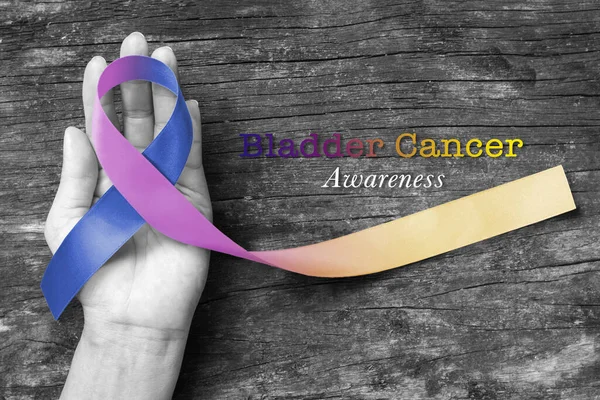 Bladder cancer Stock Photos, Royalty Free Bladder cancer Images ...
