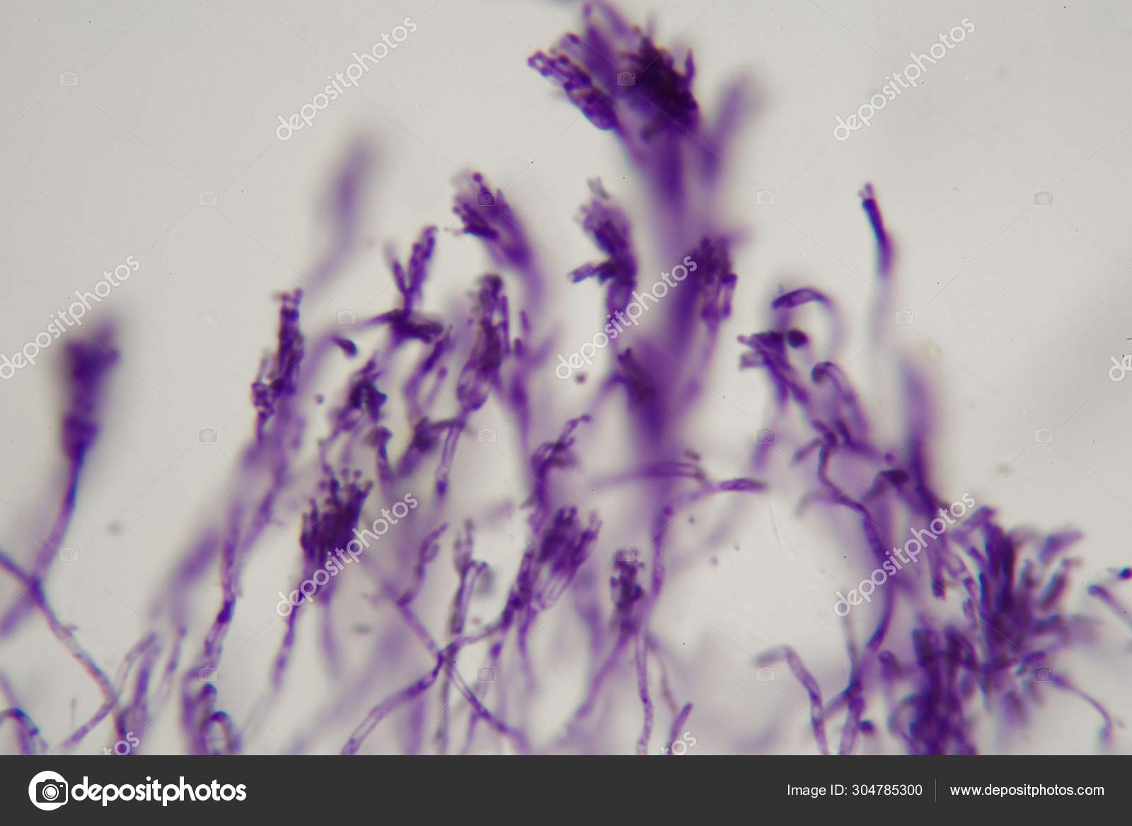 Microscope photo a bundle of Penicillium fungi Stock Photo by ©ChWeiss ...