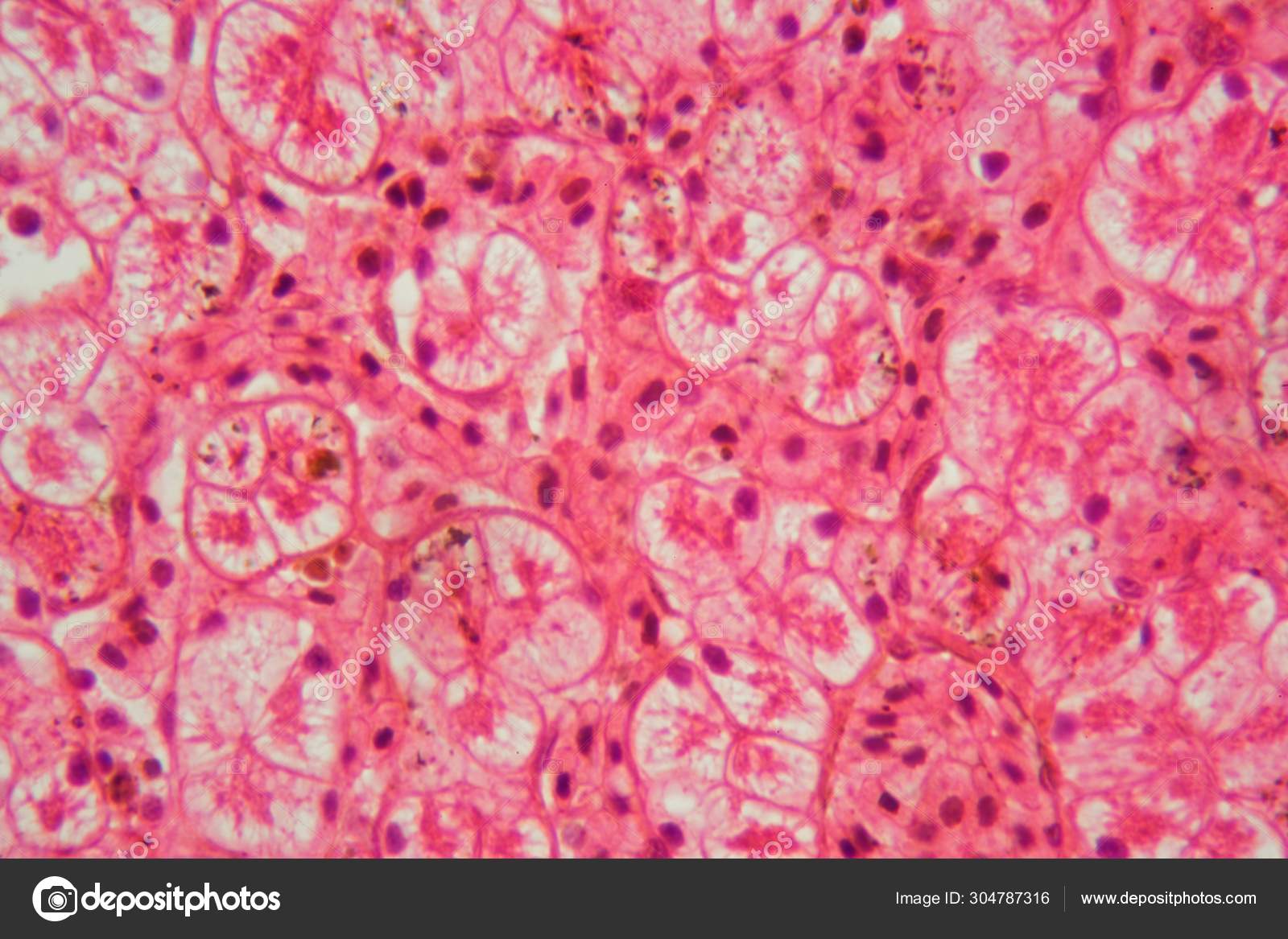 Liver Cell Under Microscope