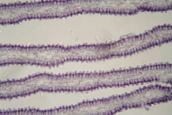 Coprinus Slide Labeled Basidia