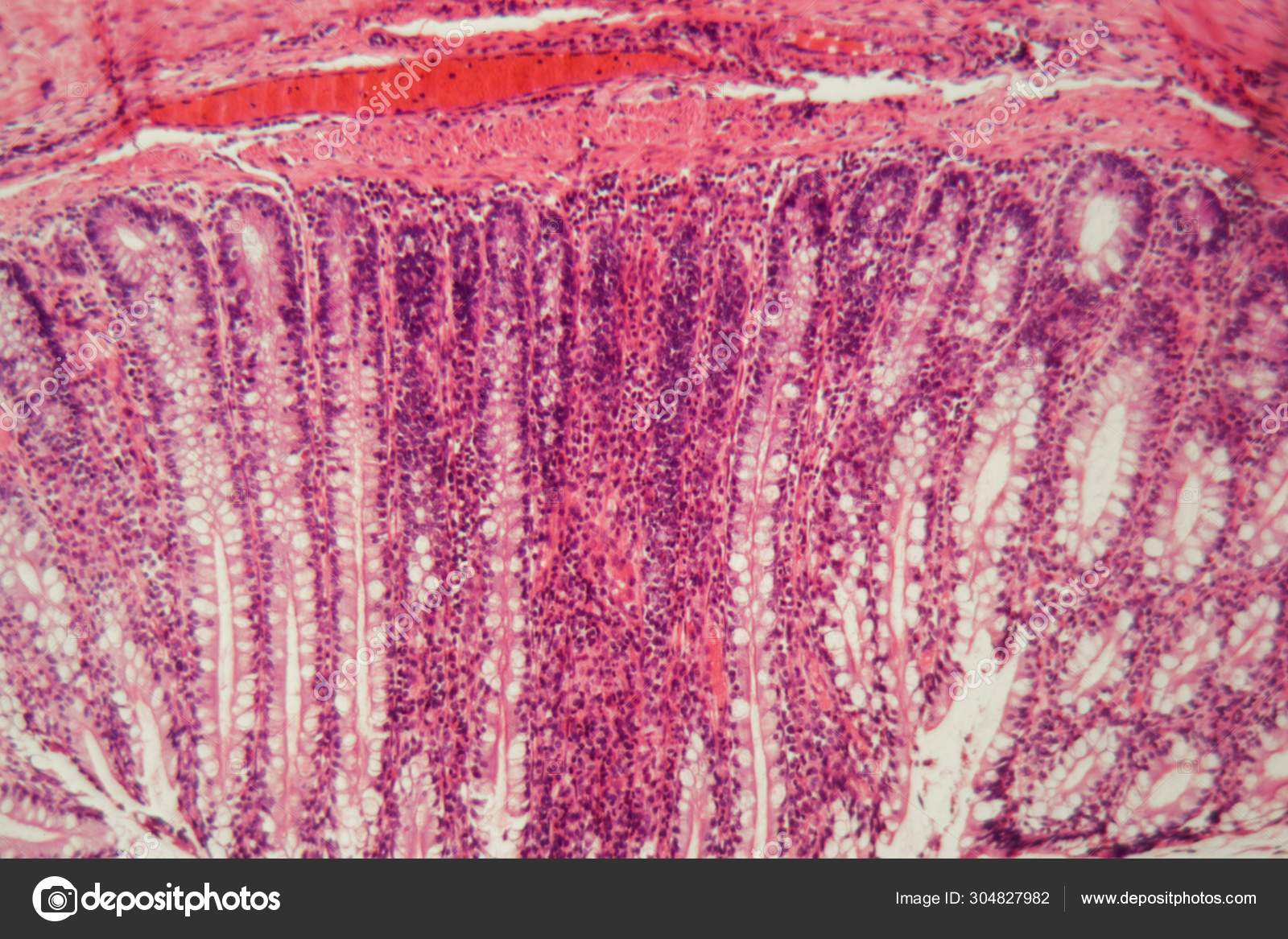 Simple Columnar Epithelium 100x