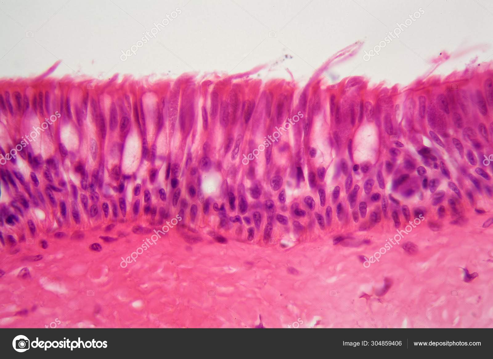 Ciliated Epithelium Labeled