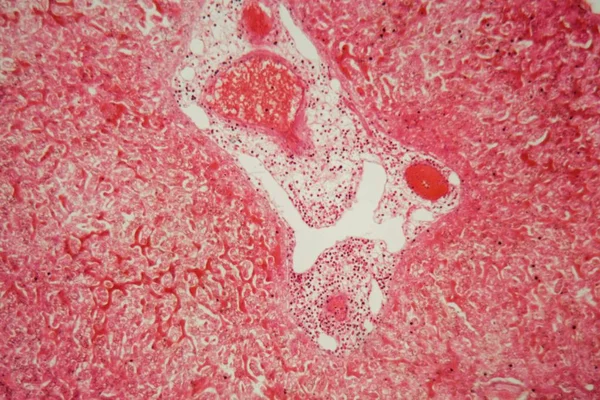 Liver cells under the microscope - Stock Image - Everypixel