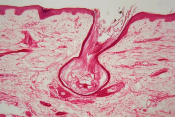 Hair Follicle Microscope