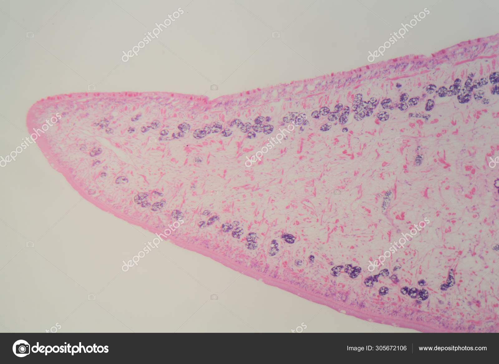 Liver Fluke Under Microscope