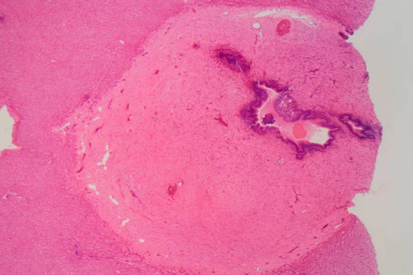 Lipome images libres de droit, photos de Lipome | Depositphotos