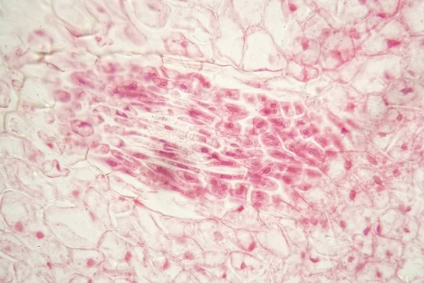 Root bacteria nodules under the microscope. — Stock Photo © ChWeiss ...