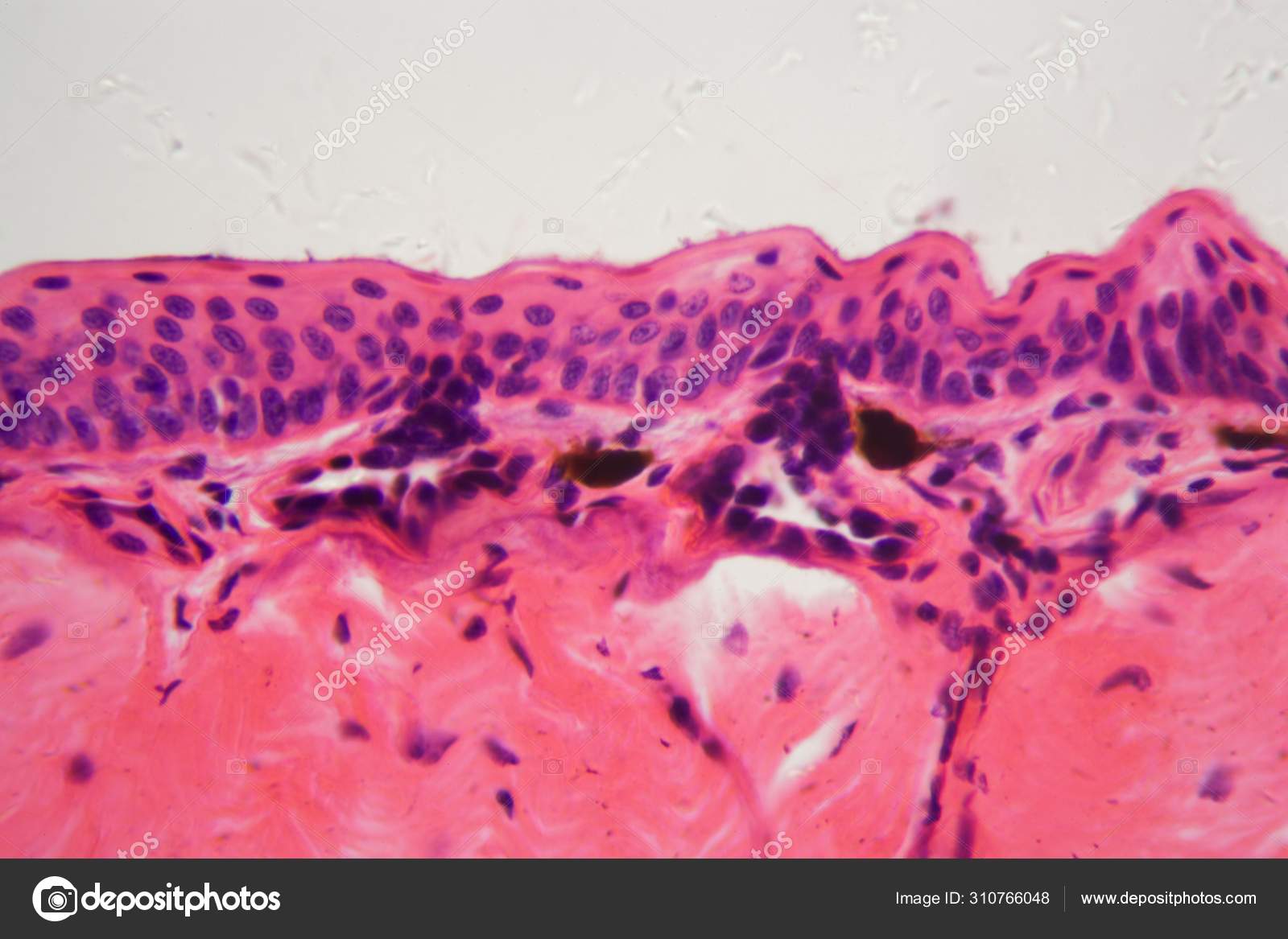 Amphibian skin with ulcer under a microscope — Stock Photo © ChWeiss ...