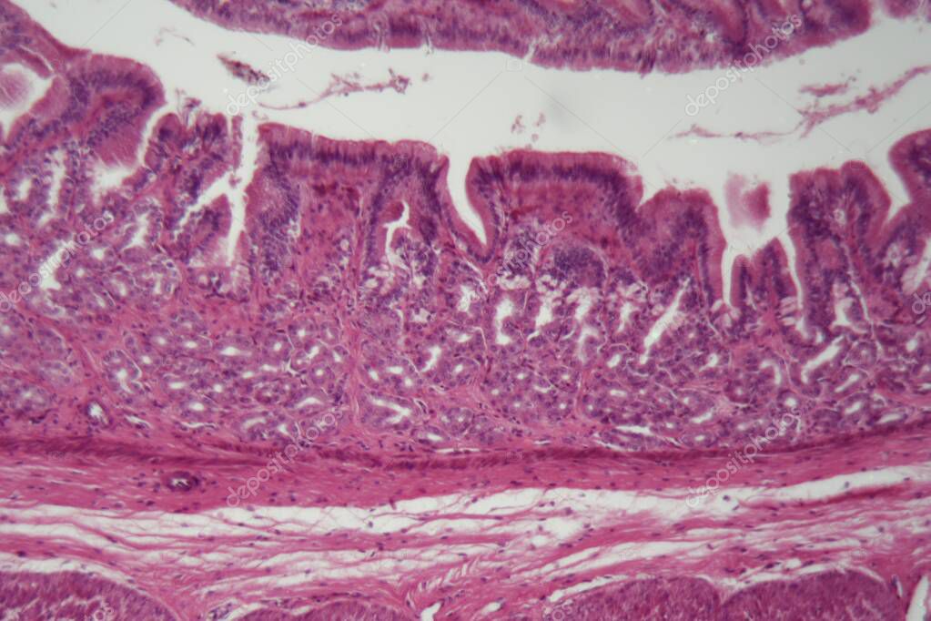 Microscopio foto de una sección a través de células musculares lisas ...